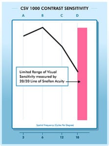 Contrast Sensitivity Testing – How Is it Different Than Visual Acuity?
