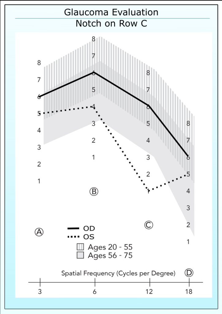 Contrast Sensitivity – Glaucoma Detection and Treatment Evaluation